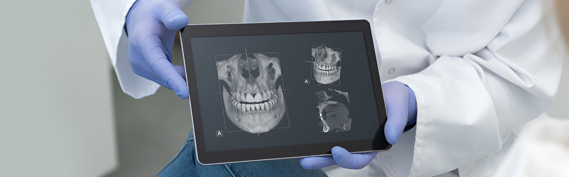 Cone Beam Computed Tomography Cbct Lifestyle Dentistry